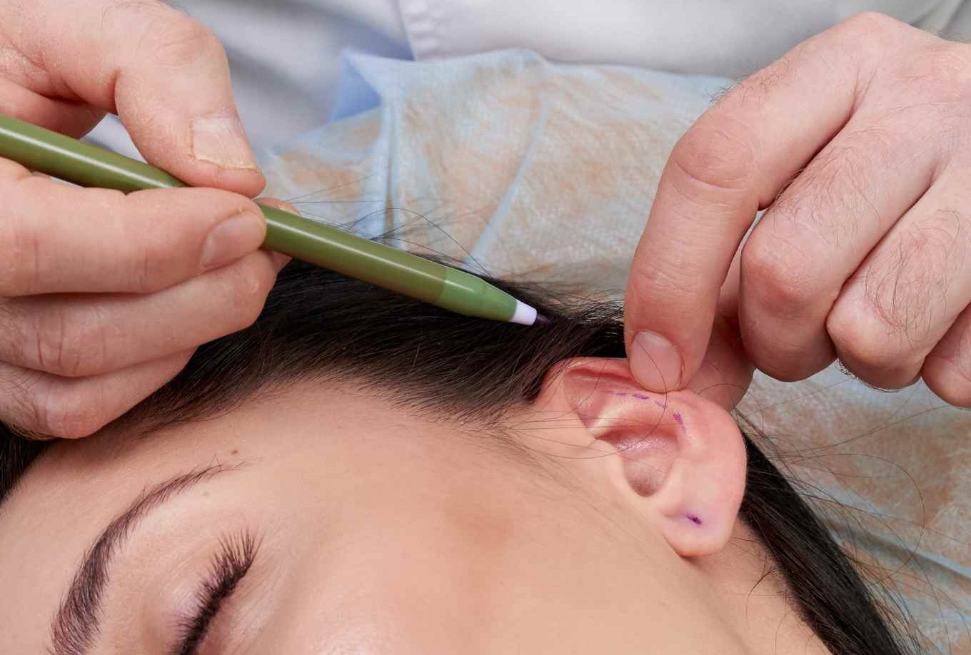 Oorcorrectie specialist in Haarlem - Consult binnen een week